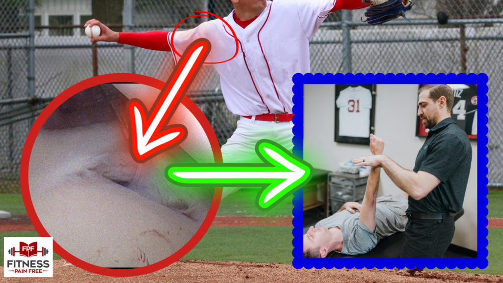 6 Keys to SLAP Tear Physical Therapy [Guide for Physios] - FPF Show ...