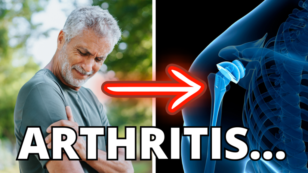 Shoulder OSTEOARTHRITIS - Evidence Based Guide for Physical Therapists ...